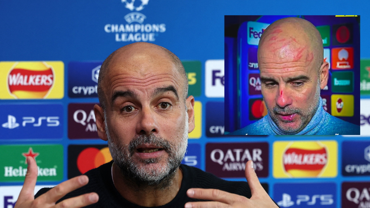 Guardiola: Las polémicas declaraciones sobre sus arañazos - Noticia Impacto